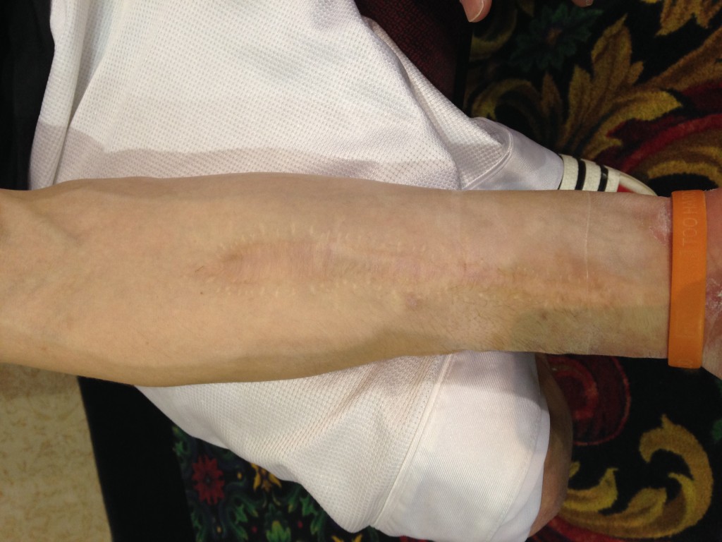 2014 Winter Cup: Chris Brooks on Broken Bones, Blaniks, and Rio - GymCastic